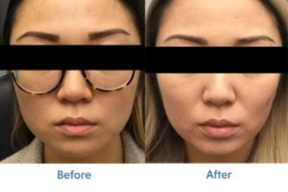 Cosmetic Archives - Page 2 of 3 - The Dermatology Specialists