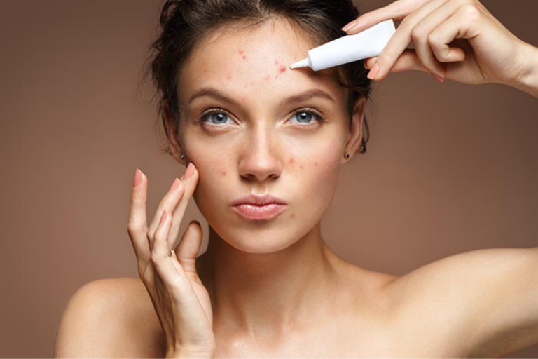 The Side Effects of Accutane: What’s Common and What’s Not - The ...