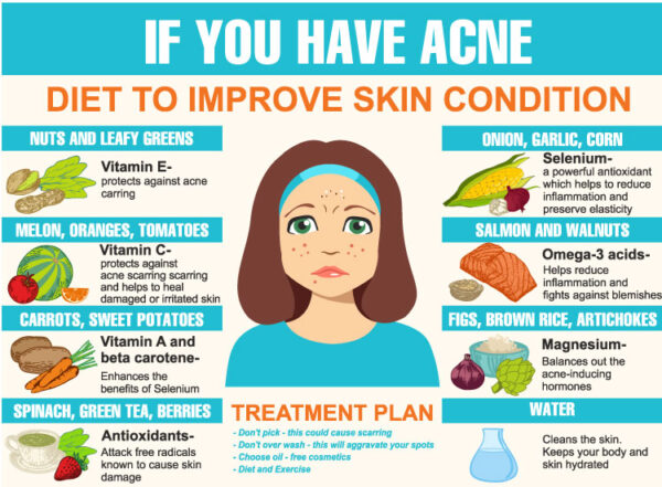 5 Foods That Cause Acne and Breakouts - The Dermatology Specialists