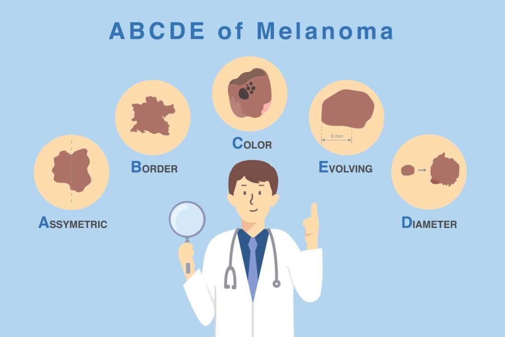 Skin Cancer Awareness Month: Protect Your Skin, Save Your Life - The ...